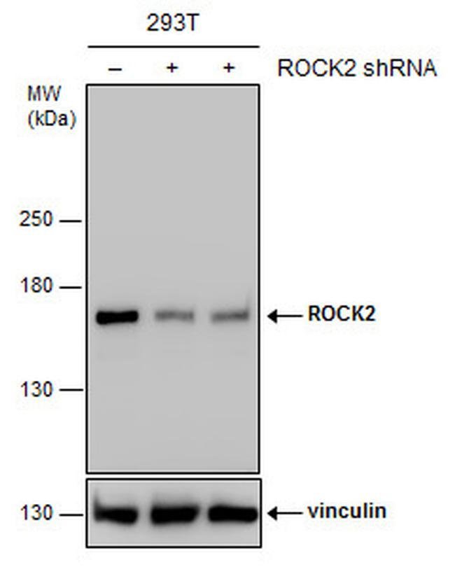 ROCK2 Polyclonal Antibody, Invitrogen 100 μL; Unconjugated:Antibodies ...