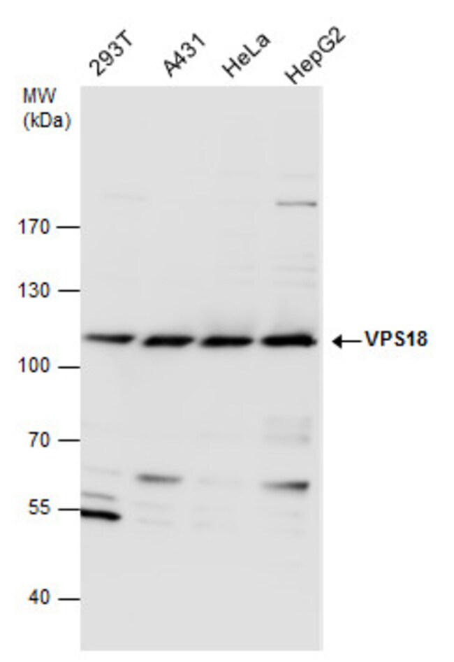 Invitrogen VPS18 Polyclonal Antibody 100 μL; Unconjugated:Antibodies ...