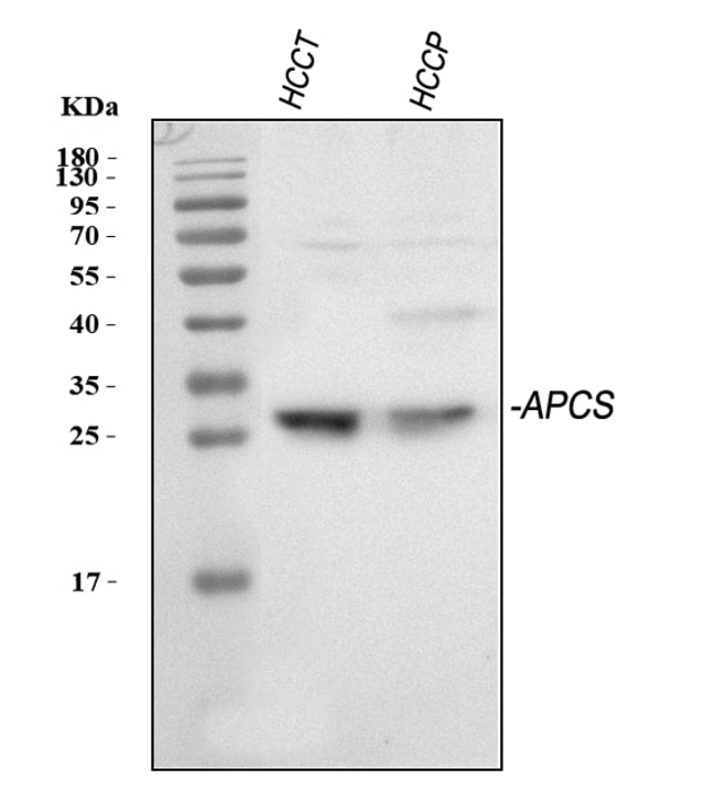 Invitrogen Serum Amyloid P Polyclonal Antibody 100 μg; Unconjugated ...