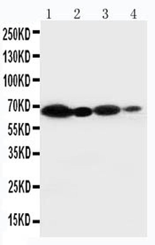 Invitrogen NOX2 Polyclonal Antibody 100 μg; Unconjugated:Antibodies ...