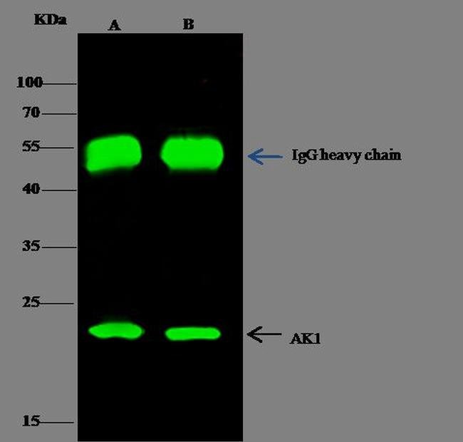 Adenylate Kinase 1 Polyclonal Antibody, Invitrogen 100 μL; Unconjugated ...
