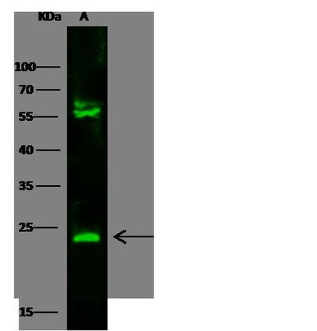 Adenylate Kinase 1 Polyclonal Antibody, Invitrogen 100 μL; Unconjugated ...