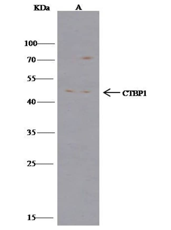 CtBP1 Polyclonal Antibody, Invitrogen 100 μL; Unconjugated:Antibodies ...