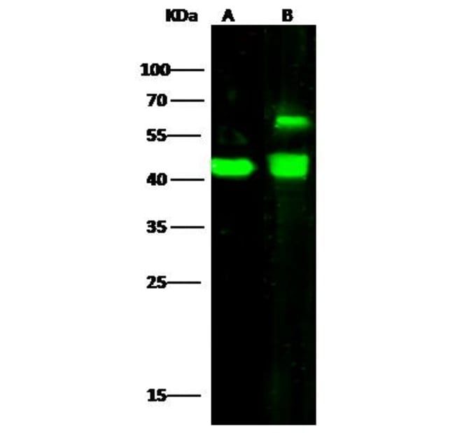 ENO3 Polyclonal Antibody, Invitrogen 100 μL; Unconjugated:Antibodies ...