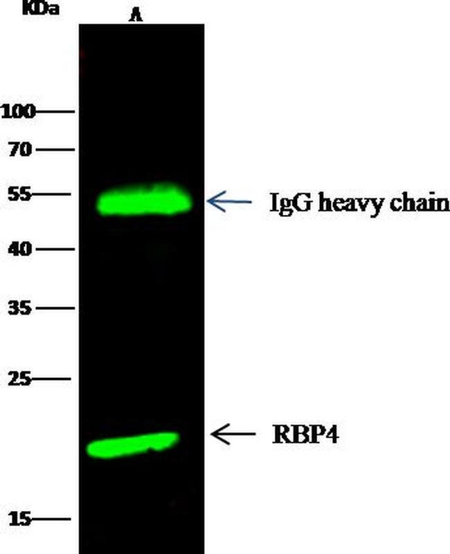 RBP4 Polyclonal Antibody, Invitrogen 100 μL; Unconjugated:Antibodies ...