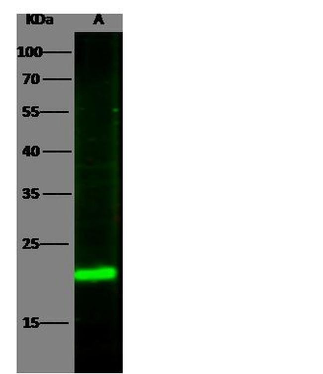 RBP4 Polyclonal Antibody, Invitrogen 100 μL; Unconjugated:Antibodies ...