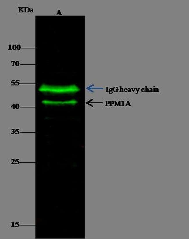 PPM1A Polyclonal Antibody, Invitrogen 100 μL; Unconjugated:Antibodies, | Fisher Scientific