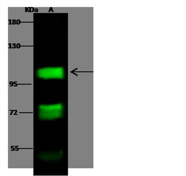 NR3C2 Polyclonal Antibody, Invitrogen 100 μL; Unconjugated:Antibodies ...