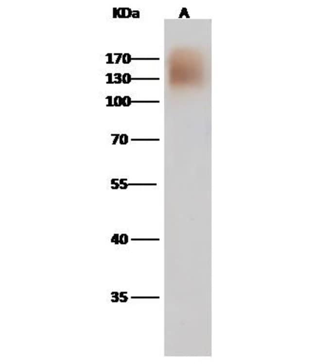 Coronavirus Spike Protein Polyclonal Antibody, Invitrogen 100 μL ...