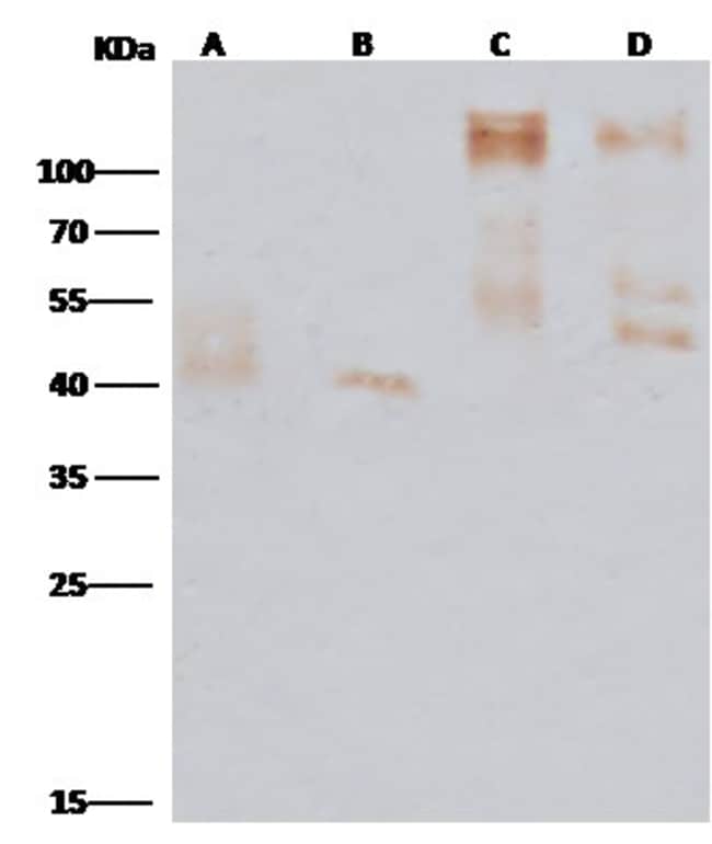 Invitrogen Ebola Virus GP (subtype Zaire, strain Mayinga 1976 ...