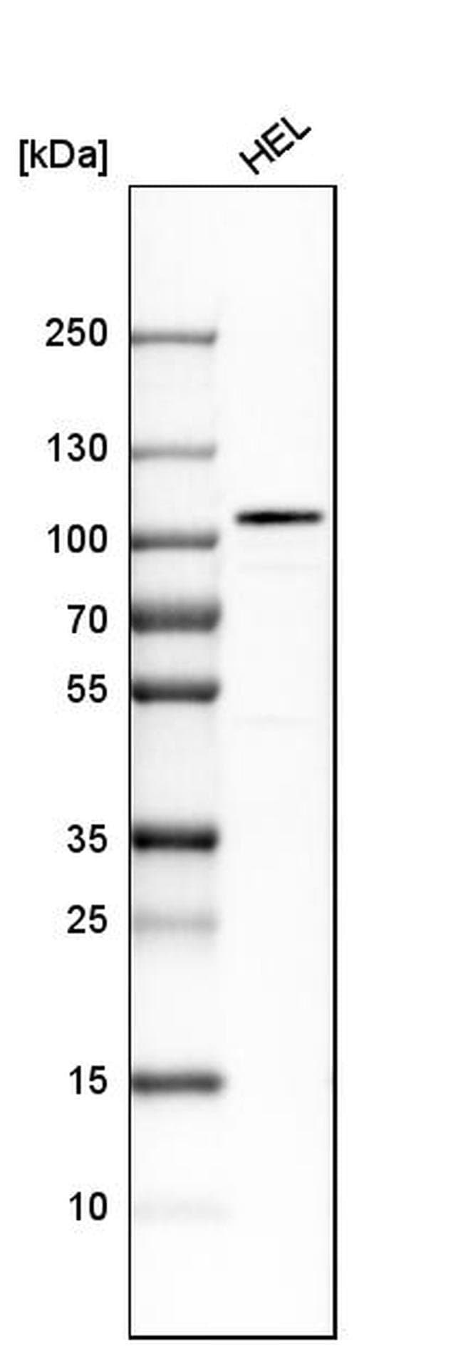 SATB2 Polyclonal Antibody, Invitrogen 100 μL; Unconjugated:Antibodies ...