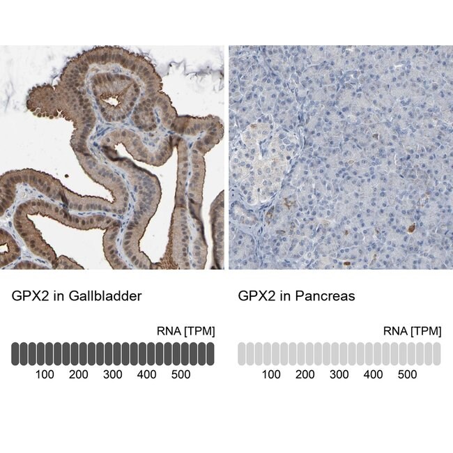 GPX2 Polyclonal Antibody, Invitrogen 100 μL; Unconjugated:Antibodies ...