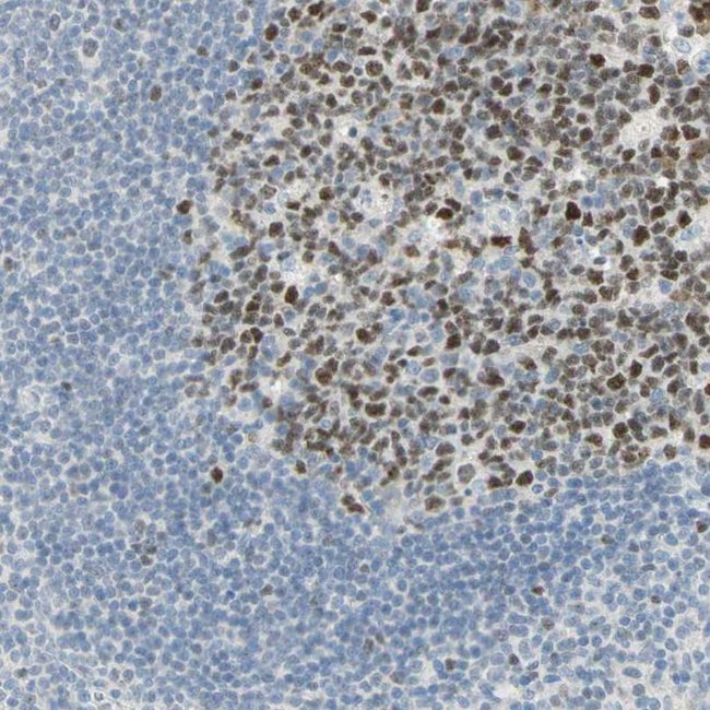 BCL6 Polyclonal Antibody, Invitrogen™ 100 μL; Unconjugated | Fisher ...