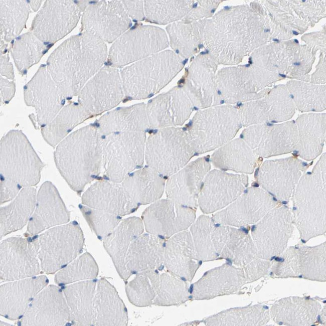 Invitrogen alpha-II Spectrin Polyclonal Antibody 100 μL; Unconjugated ...