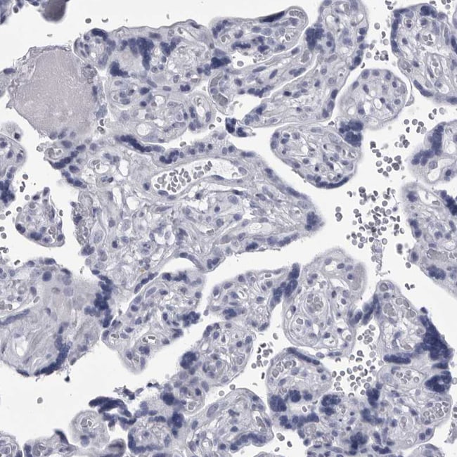 Invitrogen Ankyrin B Polyclonal Antibody 100 μL; Unconjugated ...