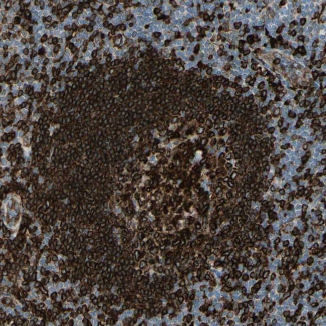 CD74 Polyclonal Antibody, Invitrogen 100 μL; Unconjugated:Antibodies ...