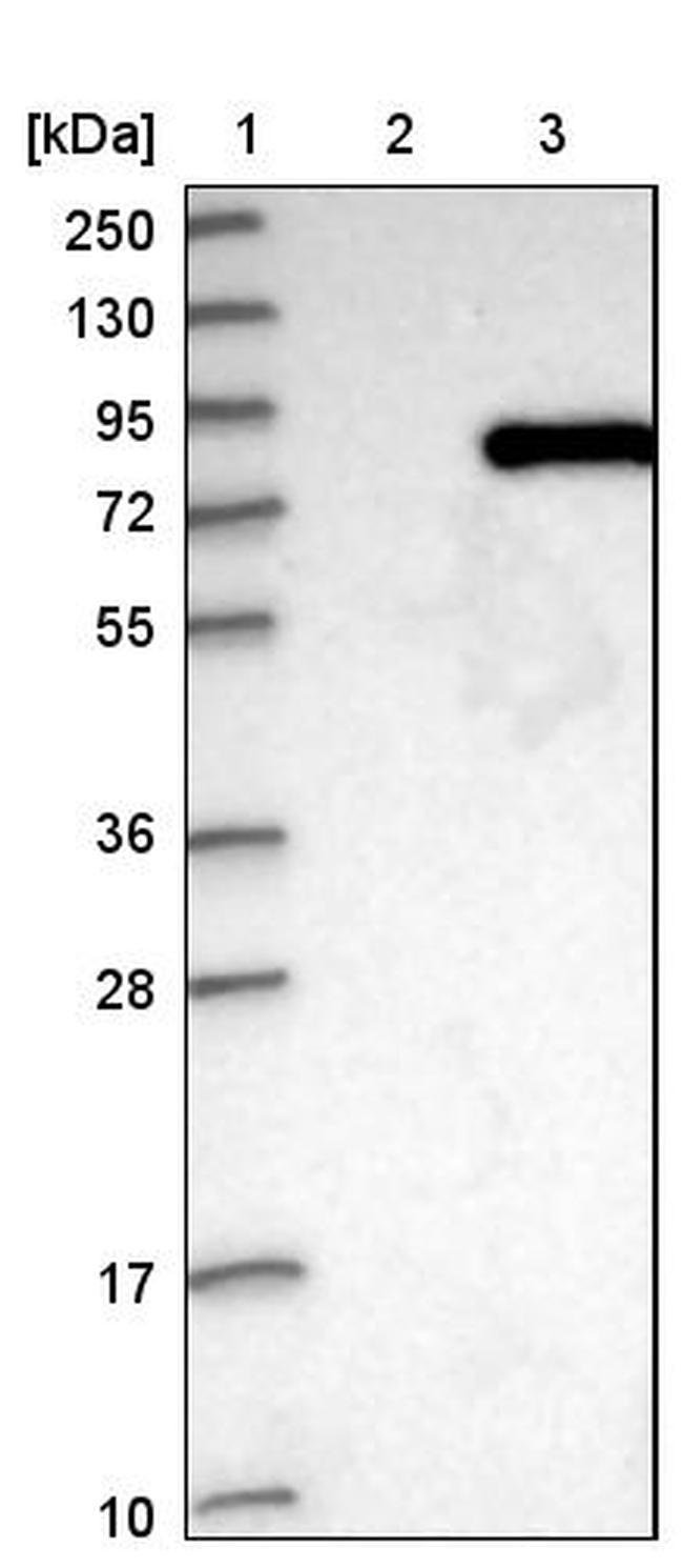 ACSL3 Rabbit anti-Human, Polyclonal, Invitrogen 100 µL; Unconjugated ...