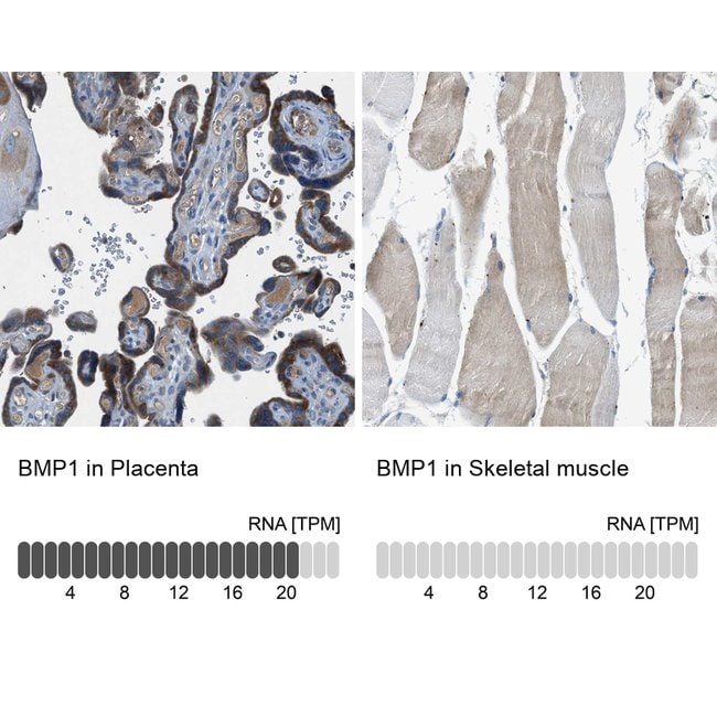BMP1 Polyclonal Antibody, Invitrogen 100 μL; Unconjugated:Antibodies ...