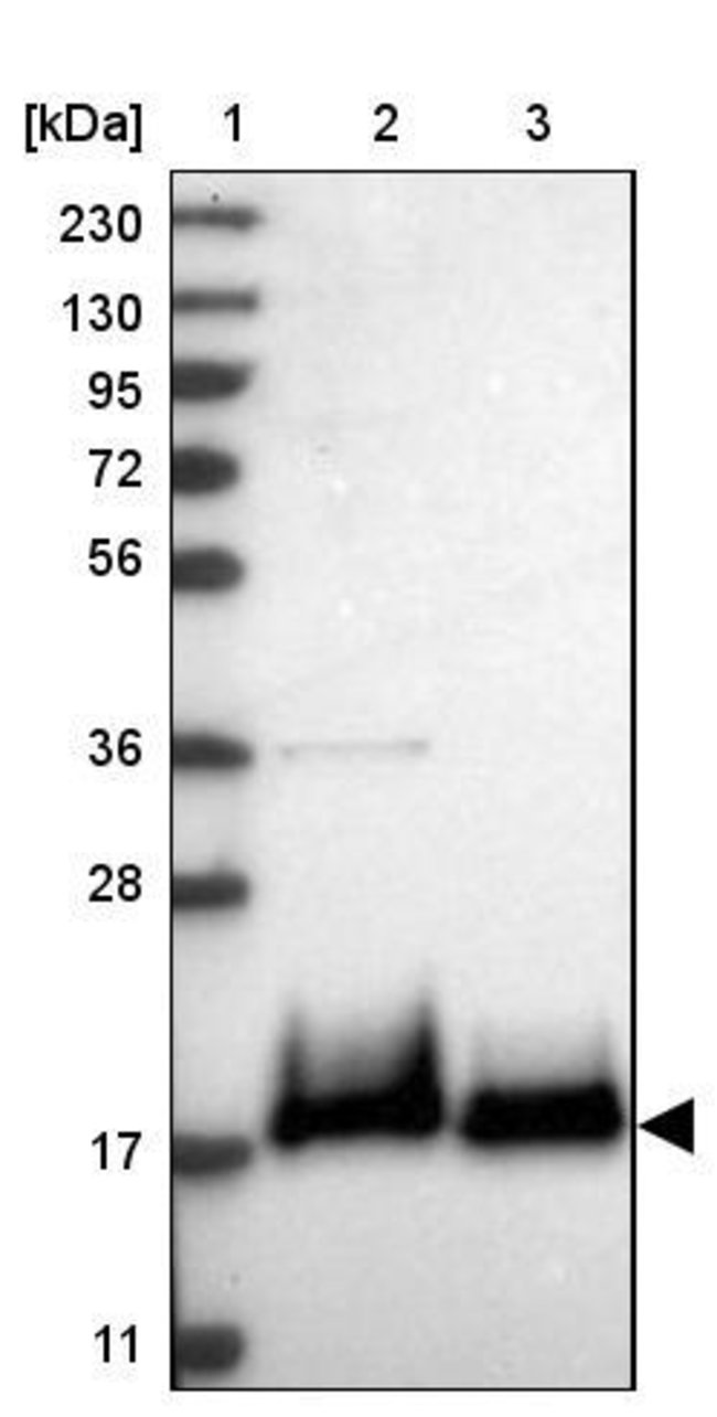 CD59 Rabbit anti-Human, Polyclonal, Invitrogen 100 µL; Unconjugated ...