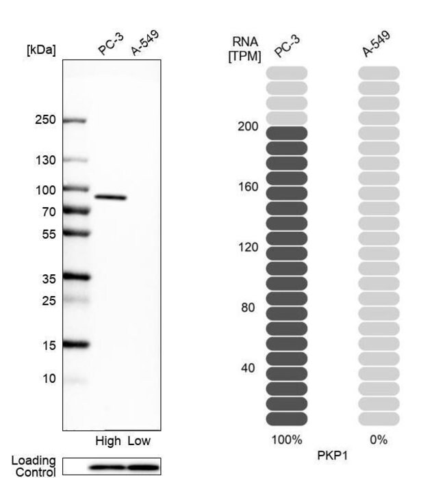 PKP1 Polyclonal Antibody, Invitrogen 100 μL; Unconjugated:Antibodies ...
