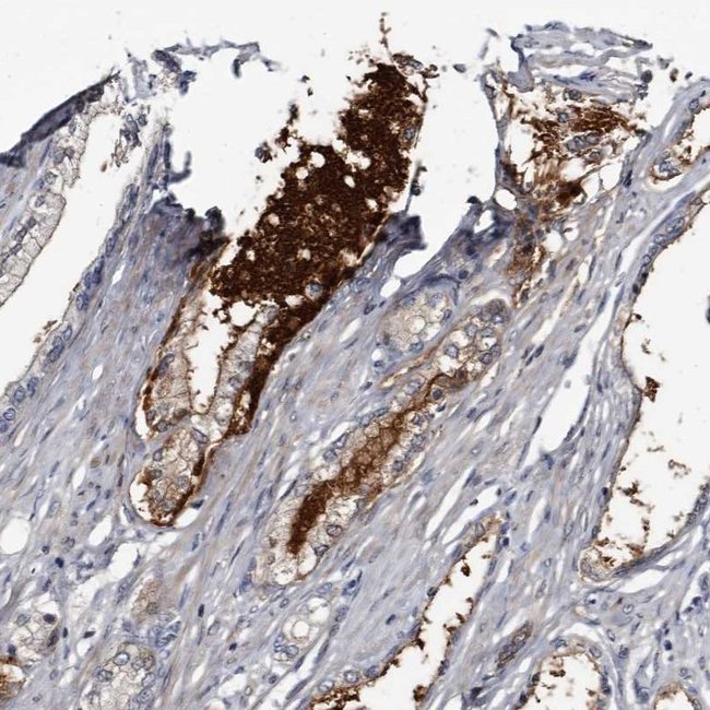 Prostasin Polyclonal Antibody, Invitrogen 100 μL; Unconjugated ...