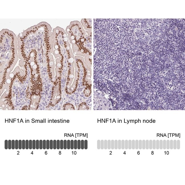 HNF1A Polyclonal Antibody, Invitrogen 100 μL; Unconjugated:Antibodies ...