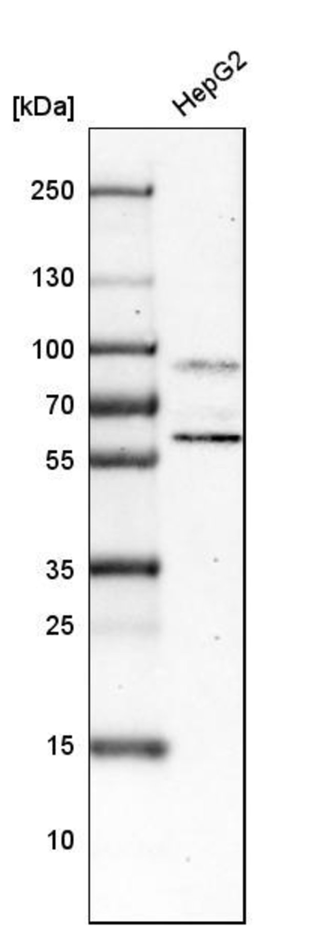 HNF1A Polyclonal Antibody, Invitrogen 100 μL; Unconjugated:Antibodies ...
