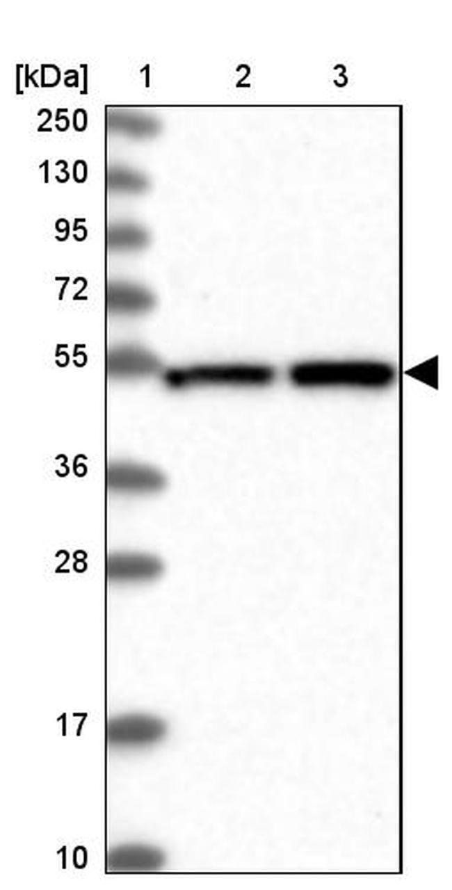 Dynactin 2 Polyclonal Antibody, Invitrogen 100 μL; Unconjugated ...