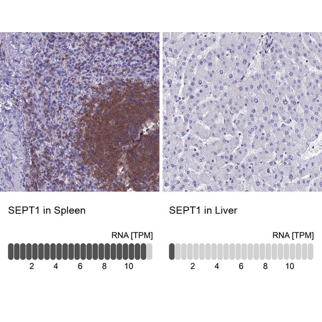 Septin 1 Polyclonal Antibody, Invitrogen 100 μL; Unconjugated ...