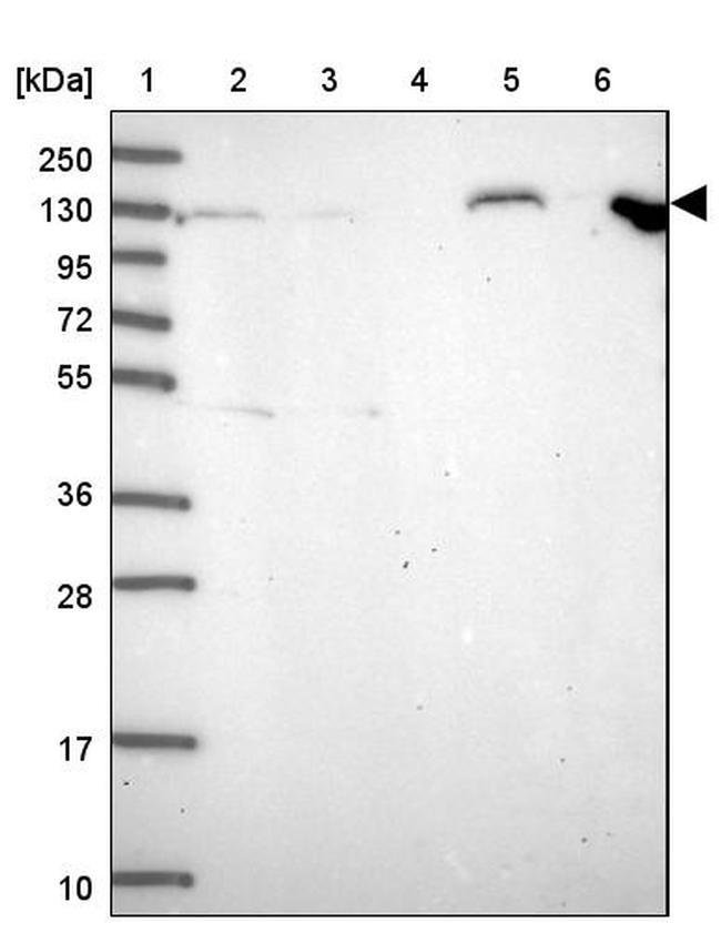 APC1 Polyclonal Antibody, Invitrogen 100 μL; Unconjugated:Antibodies ...