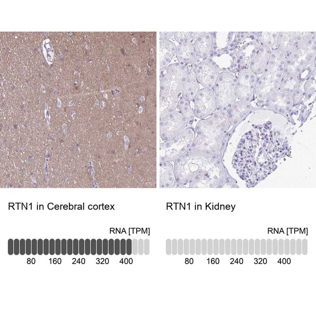 RTN1 Polyclonal Antibody, Invitrogen 100 μL; Unconjugated:Antibodies ...