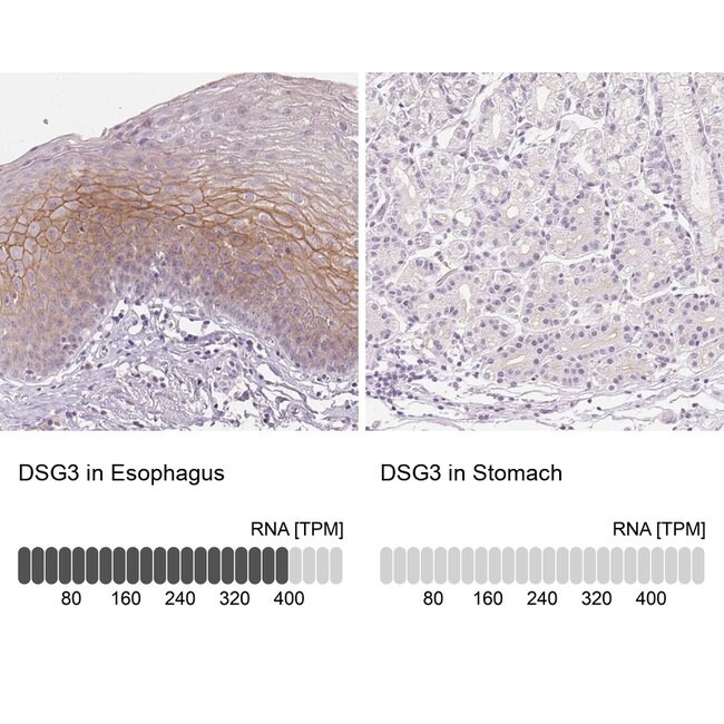 Desmoglein 3 Polyclonal Antibody, Invitrogen 100 μL; Unconjugated ...
