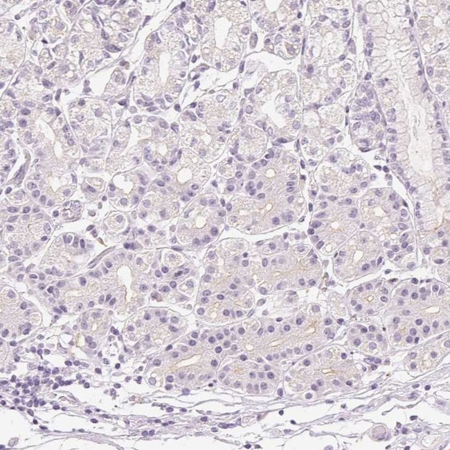 Desmoglein 3 Polyclonal Antibody, Invitrogen 100 μL; Unconjugated ...