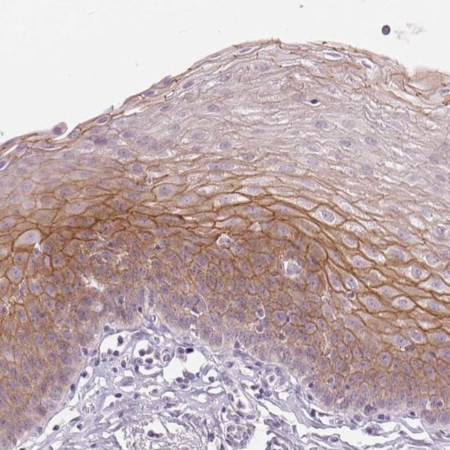 Desmoglein 3 Polyclonal Antibody, Invitrogen 100 μL; Unconjugated ...