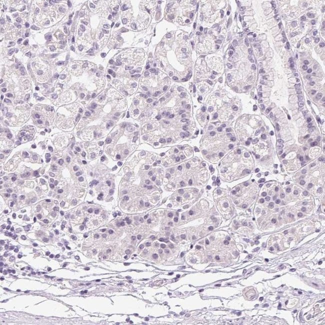 Desmoglein 3 Polyclonal Antibody, Invitrogen 100 μL; Unconjugated ...