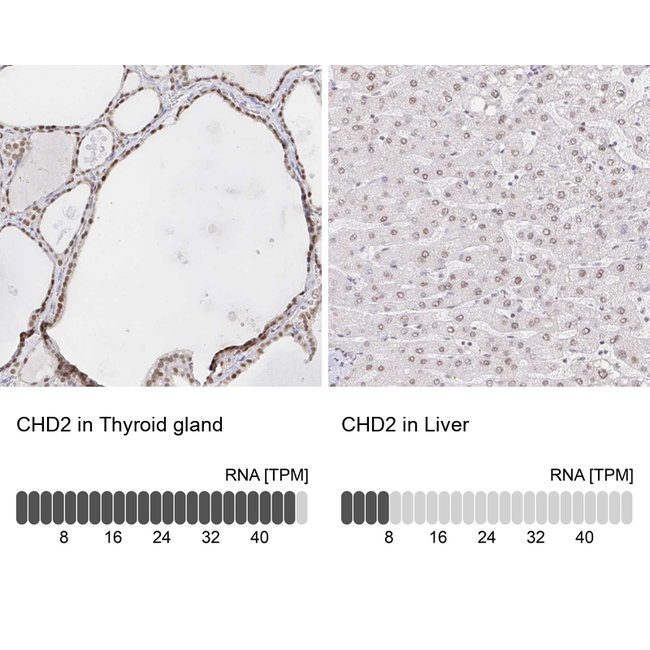CHD2 Polyclonal Antibody, Invitrogen 100 μL; Unconjugated:Antibodies ...