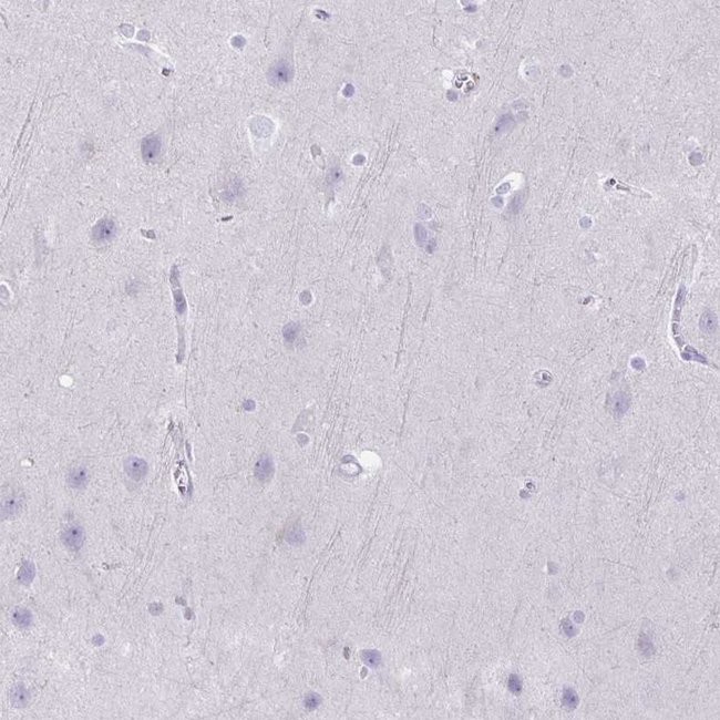 Granzyme K Rabbit anti-Human, Polyclonal, Invitrogen 100 μL ...