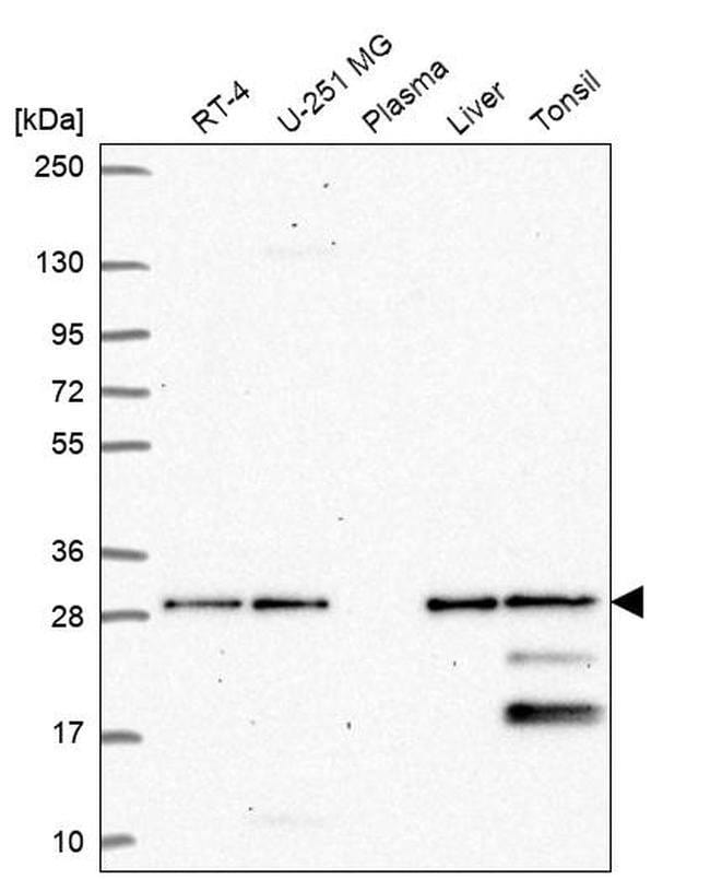 Granzyme K Rabbit anti-Human, Polyclonal, Invitrogen 100 μL ...