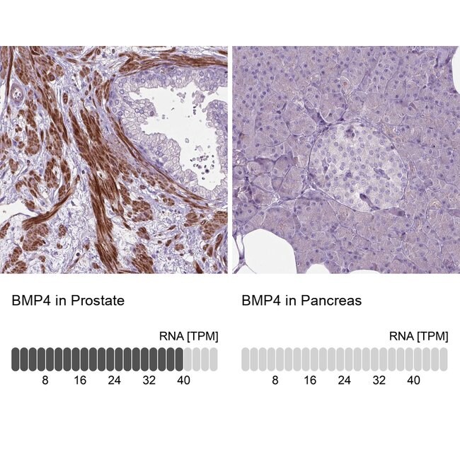 BMP-4 Polyclonal Antibody, Invitrogen 100 μL; Unconjugated:Antibodies ...
