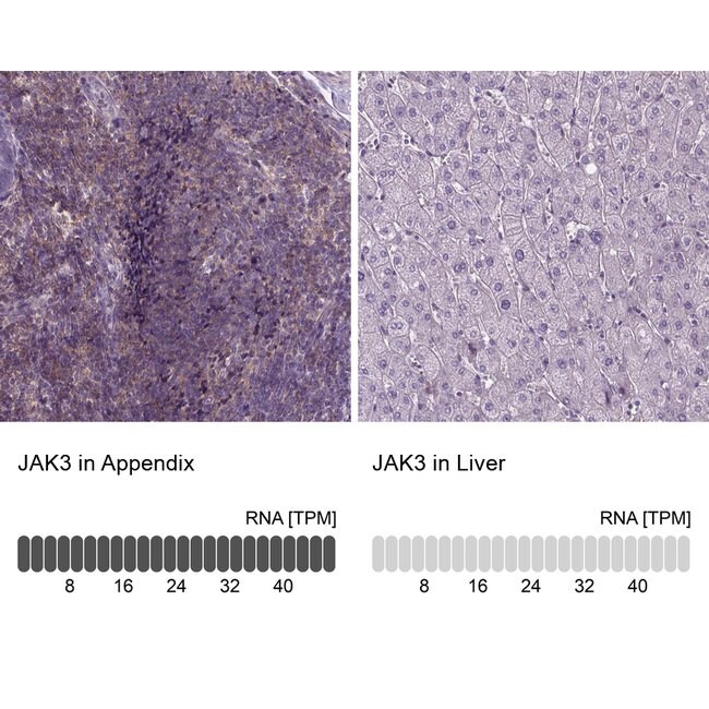 JAK3 Polyclonal Antibody, Invitrogen 100 μL; Unconjugated:Antibodies ...