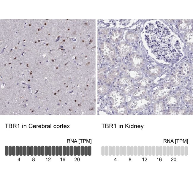 TBR1 Polyclonal Antibody, Invitrogen 100 μL; Unconjugated:Antibodies ...