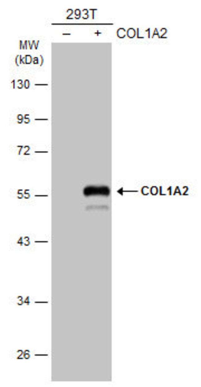 COL1A2 Polyclonal Antibody, Invitrogen 100 μL; Unconjugated:Antibodies ...