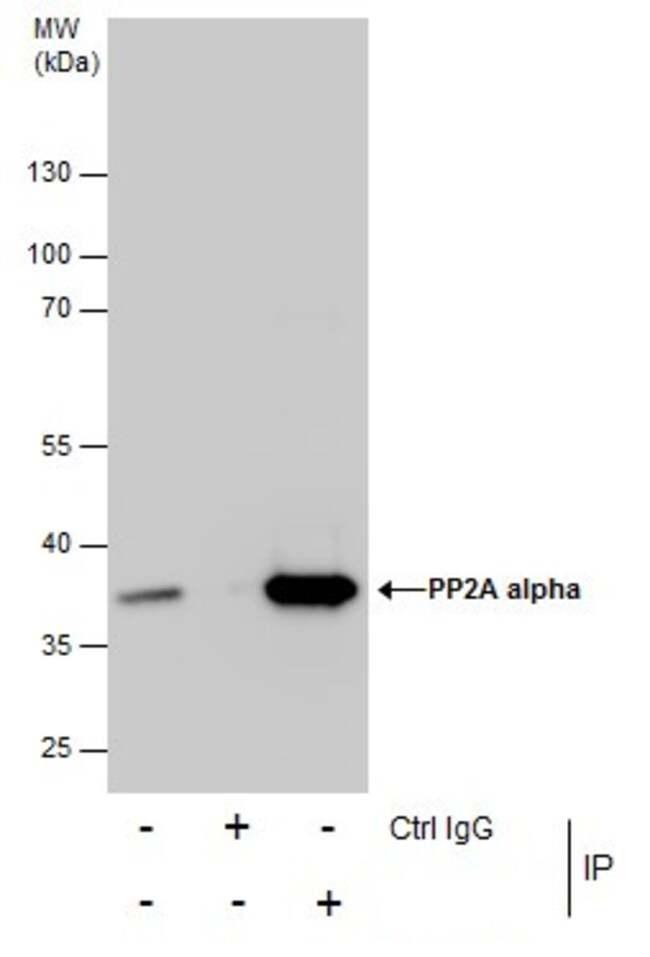 Invitrogen PP2A alpha Polyclonal Antibody 100 μL; Unconjugated ...
