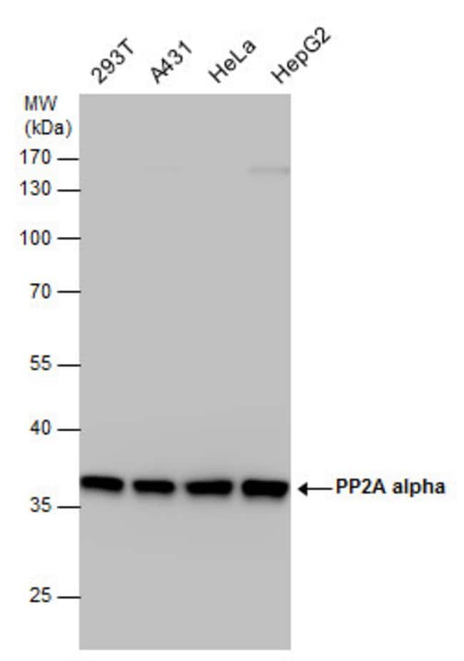 Invitrogen PP2A alpha Polyclonal Antibody 100 μL; Unconjugated:Antibodies, | Fisher Scientific