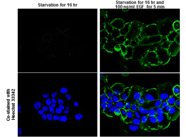 Invitrogen Phospho-EGFR (Tyr1148) Polyclonal Antibody 100 μL ...