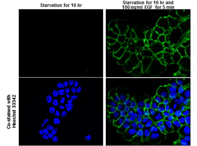 Phospho-EGFR (Tyr1173) Rabbit anti-Human, Polyclonal, Invitrogen 100 µL ...
