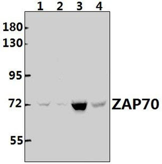Zap-70 Polyclonal Antibody, Invitrogen 100 μL; Unconjugated:Antibodies ...