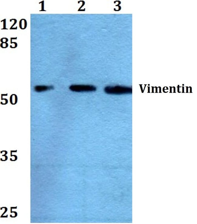 Vimentin Polyclonal Antibody, Invitrogen™ 100 μL; Unconjugated | Fisher ...