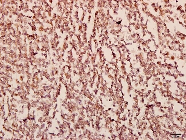 ZEB2 Polyclonal Antibody, Invitrogen 100 μL; Unconjugated:Antibodies ...