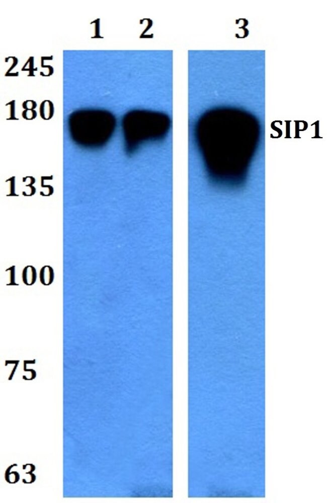 ZEB2 Polyclonal Antibody, Invitrogen 100 μL; Unconjugated:Antibodies ...